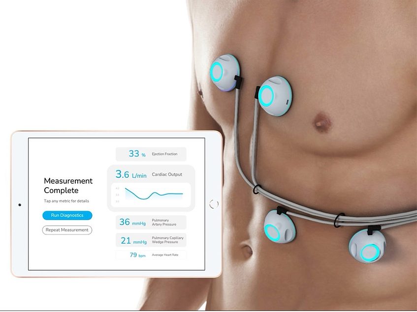 Sensydia lands $8M for AI-powered cardiac assessment tool | BioWorld