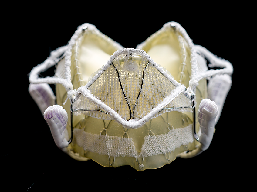 Livanova unveils plans to restructure heart valve business, end TMVR ...