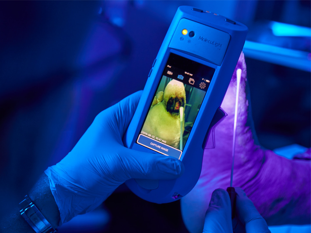 FDA gives 510(k) nod to Moleculight’s wound assessment device | 2019-12 ...