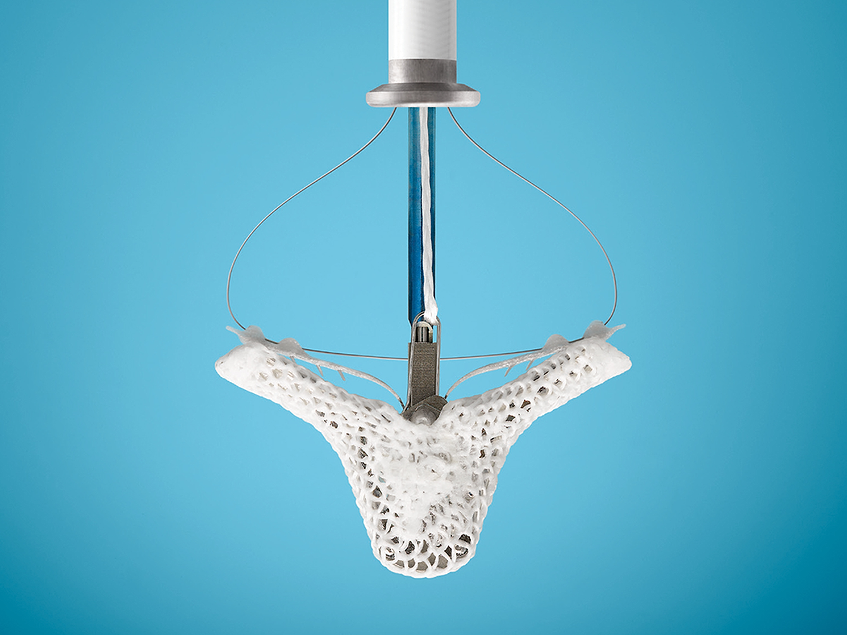 Abbott rolls out slew of data on minimally invasive structural heart ...