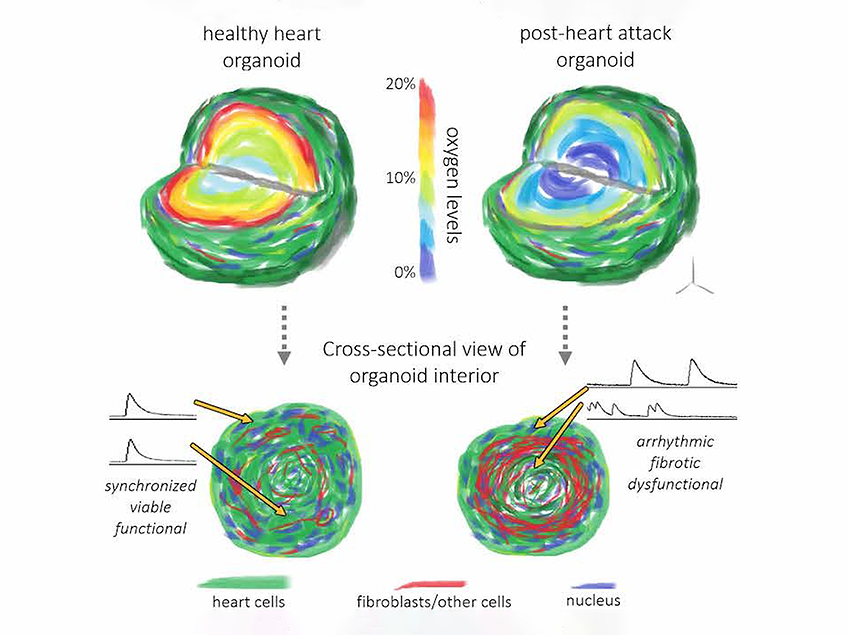 Human heart organoids provide unmatched insight into cardiac disease ...