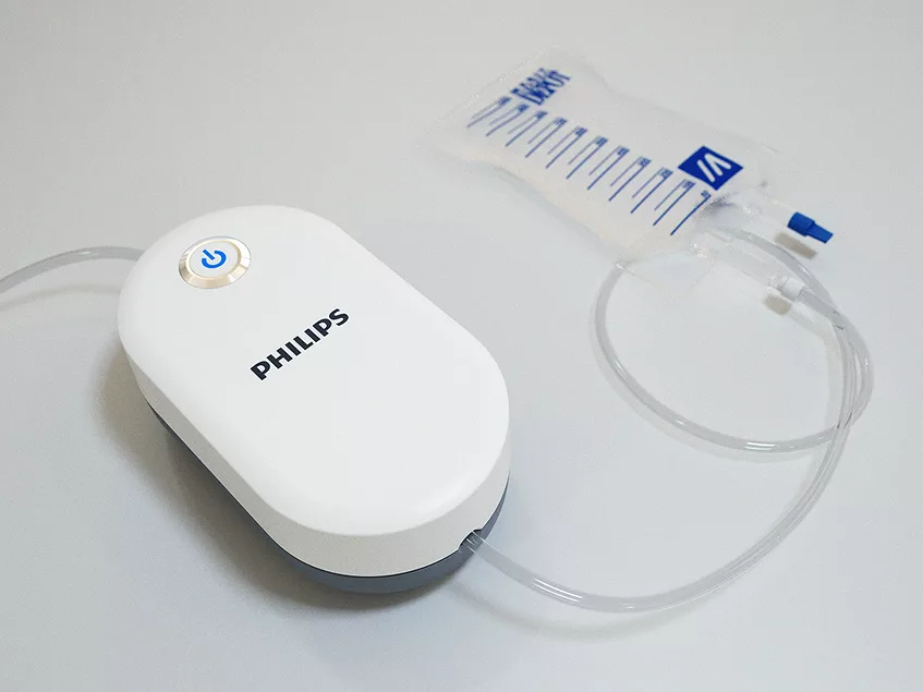 Philips launches new mechanical thrombectomy system for removing blood ...