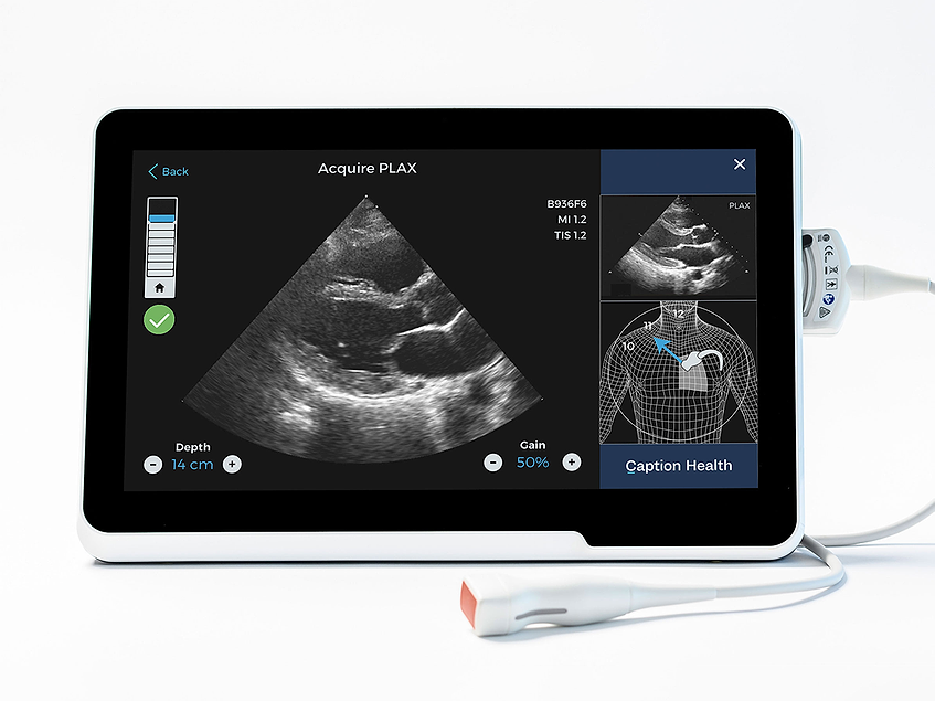 FDA gives green light to software that helps in the acquisition of ...