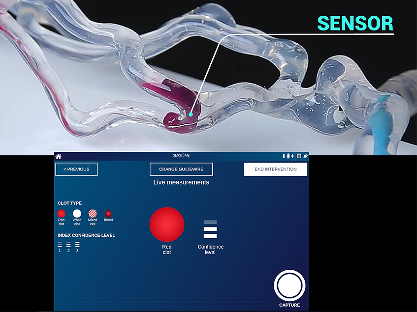 Sensome raises $9M series B funding round for Clotild guidewire | 2020 ...