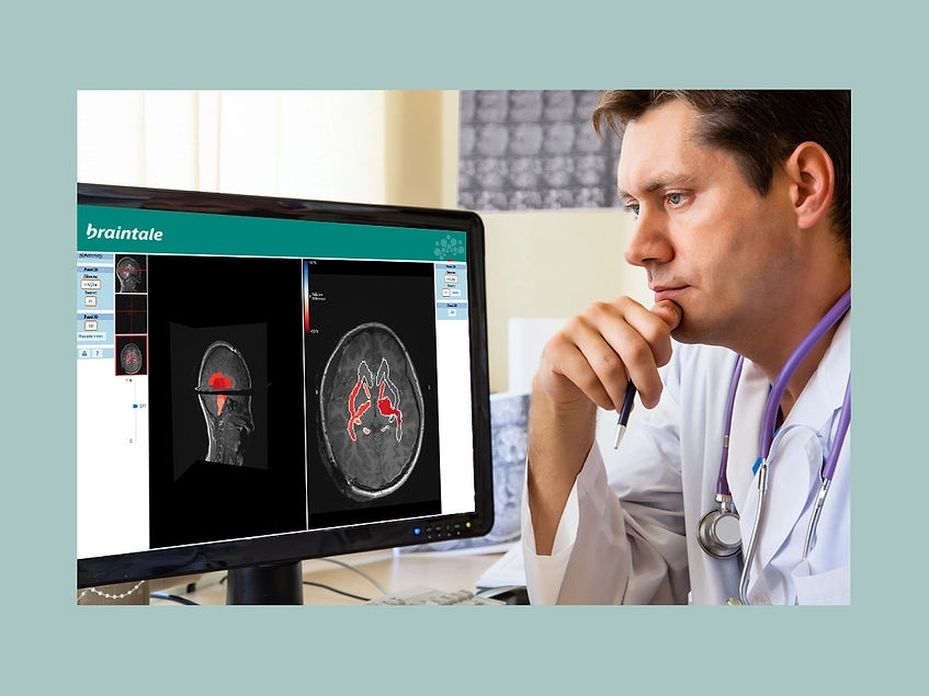 Braintale gains CE mark approval for its first quantitative brain ...