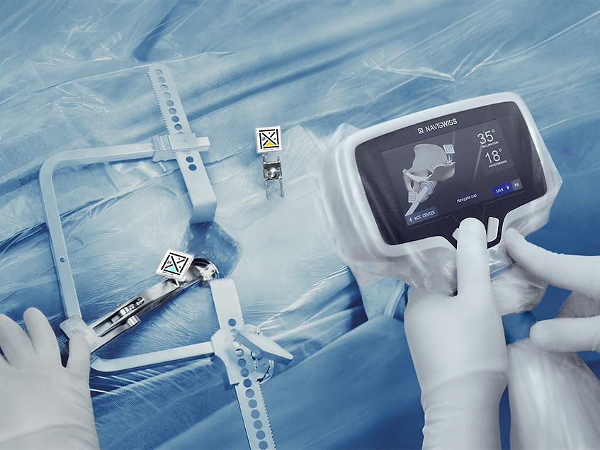 FDA gives nod to Naviswiss’ hip surgery navigation system | 2020-06-19 ...