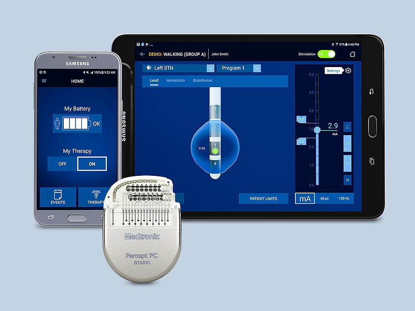 FDA gives green light to Medtronic’s DBS system with brain signal ...