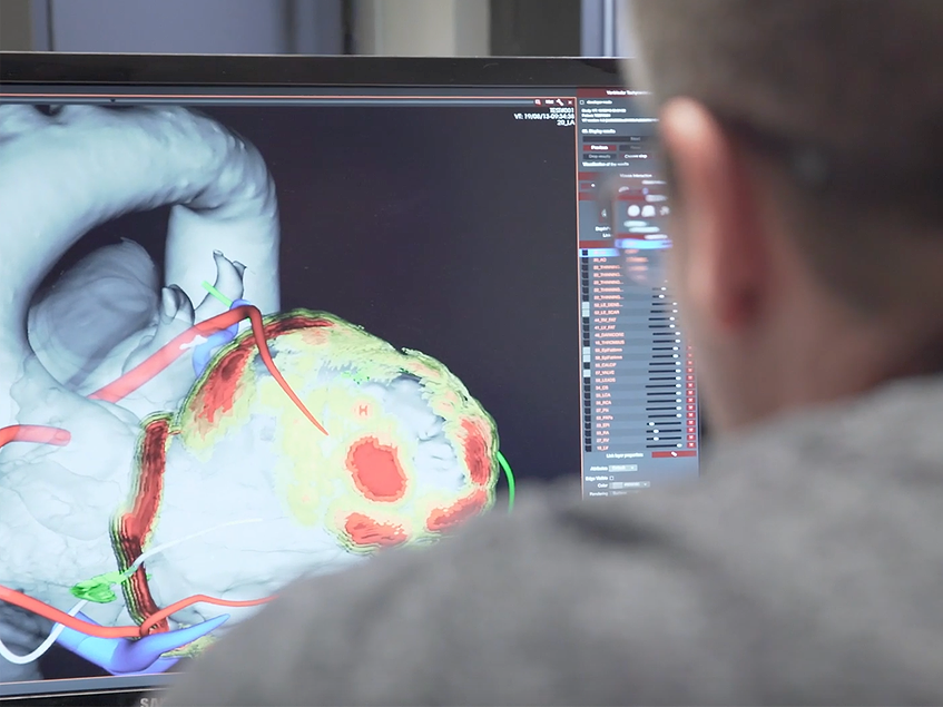 Inheart raises $4.2M for launch of its cloud-based image analysis ...