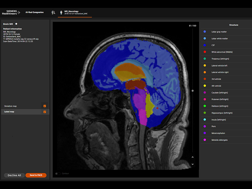 Siemens Healthineers gets FDA nod for AI-based MRI interpretation tools ...