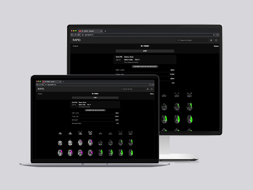 RapidAI debuts Rapid Web App, wins ISO 27001 certification | 2020-09-10 ...