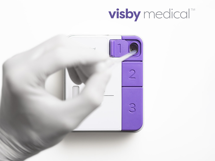 Visby lands $12.3M for development of POC and consumer versions of ...