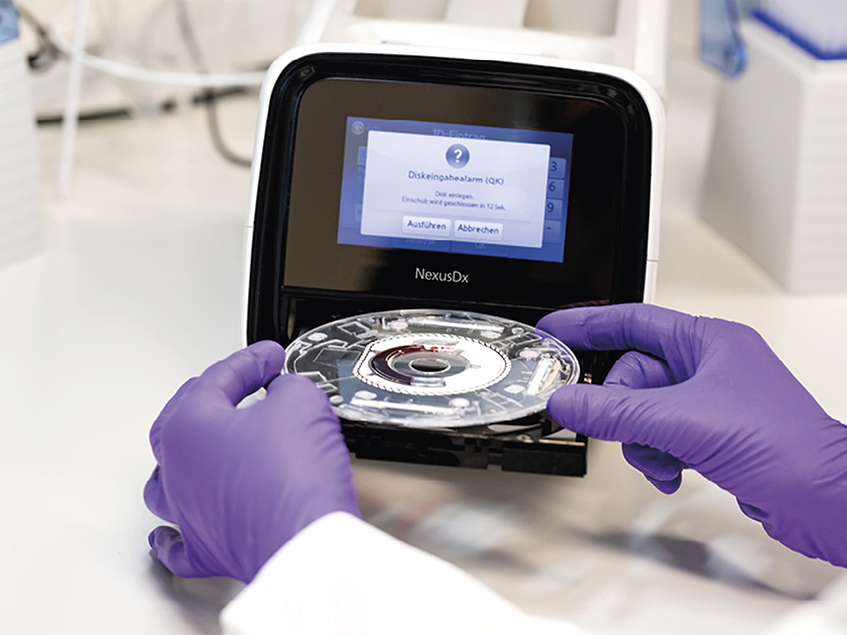 Sphingotec positions biomarker assays as personalized medicine tools in sepsis | 2021-02-23 ...