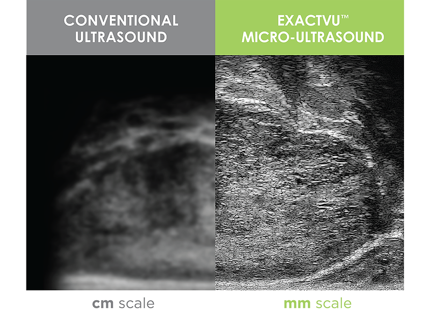 Exact Imaging secures $4M to push sales of micro-imaging platform ...