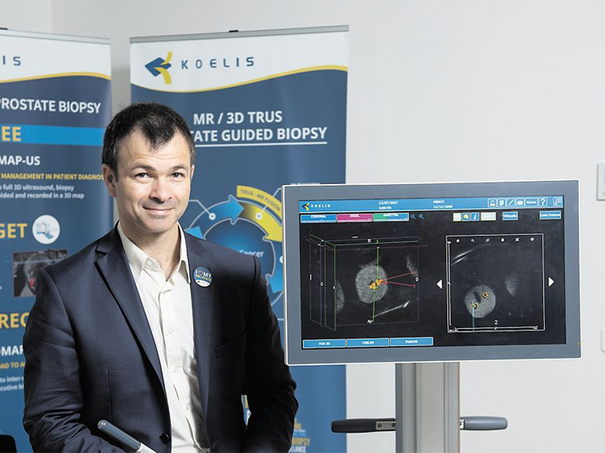Koelis reports first procedures in 3D fusion imaging-guided focal ...