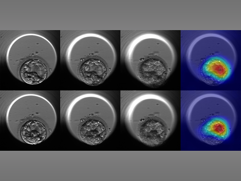 Aivf study shows AI can determine which embryos have best chance for ...