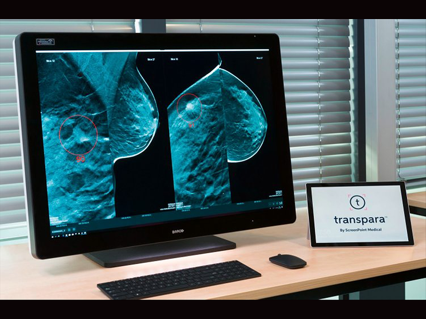 Screenpoint Medical raises $28M to ramp its smart AI solution for early ...