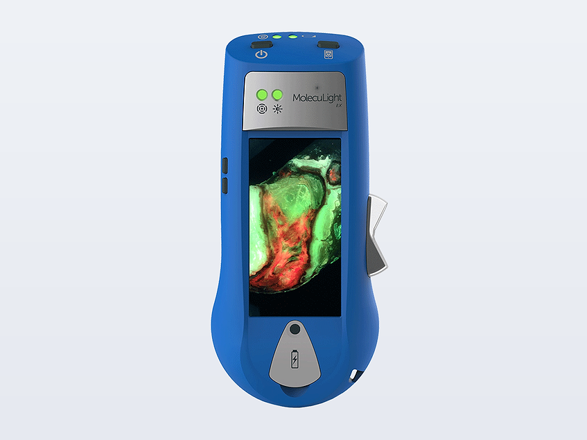 Moleculight receives FDA clearance for detection of P. aeruginosa ...