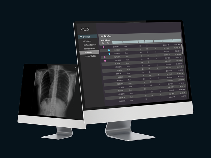 Lunit lands two FDA approvals for breast cancer detection AI and chest ...