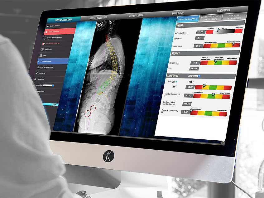 SMAIO raises $10M in IPO to ramp commercial roll-out of its spinal ...