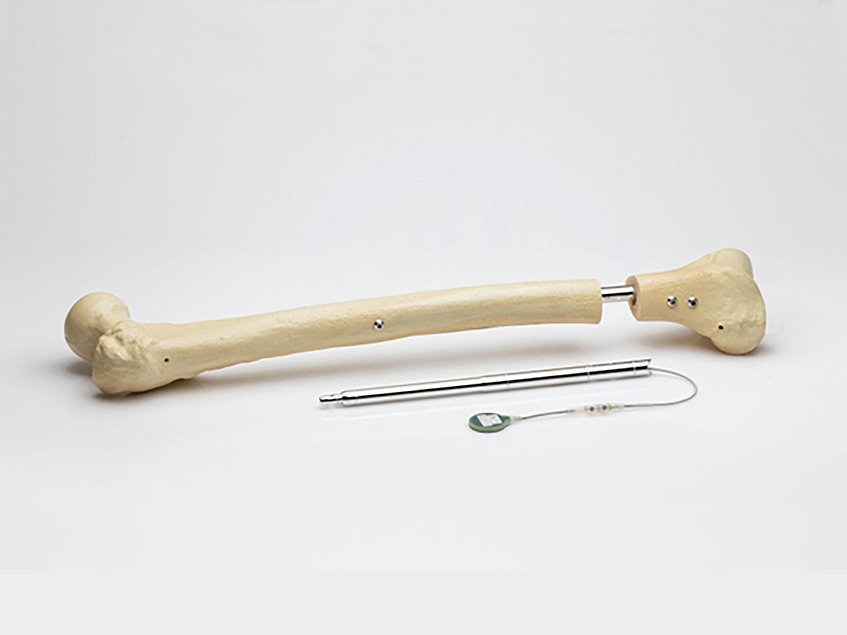 Limacorporate, Orthofix join forces to supply new high hip dislocation ...