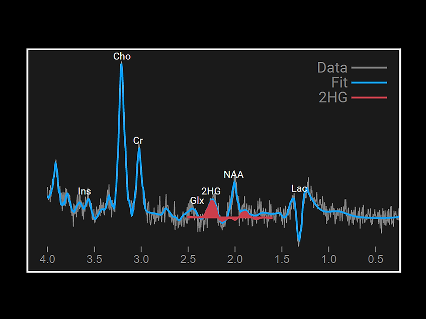 Brainspec receives FDA breakthrough device designation for virtual brain biopsy technology ...