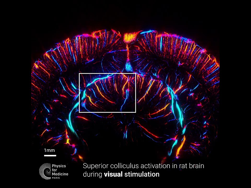 Functional ultrasound microscopy visualizes whole brain neuronal ...
