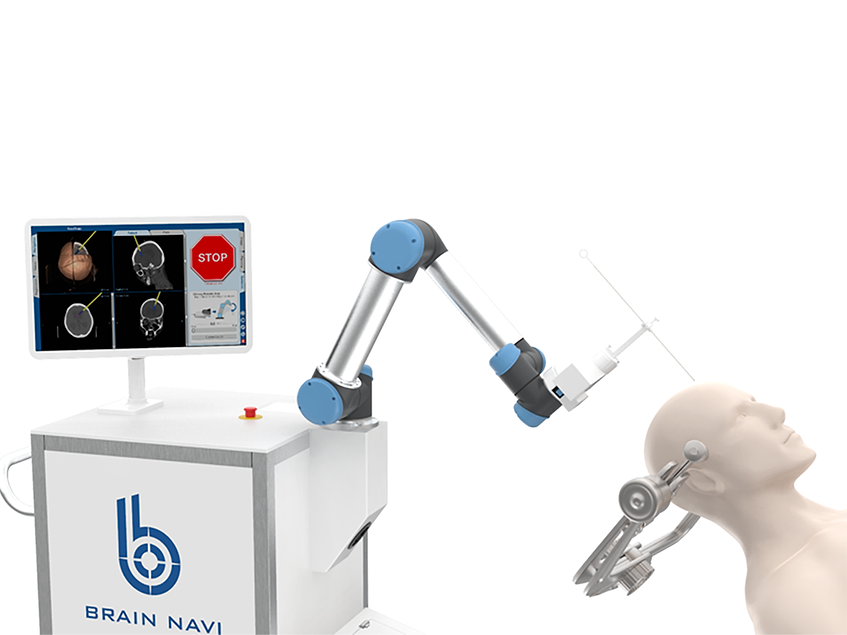 Taiwan FDA clears Brain Navi’s autonomous neurosurgical navigation ...