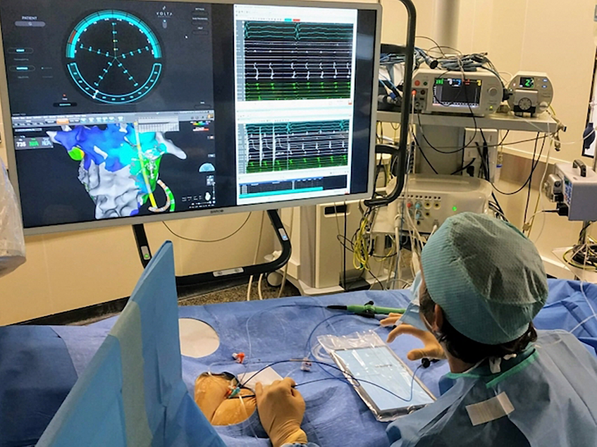 Study validates Volta's AI mapping system for atrial fibrillation ...