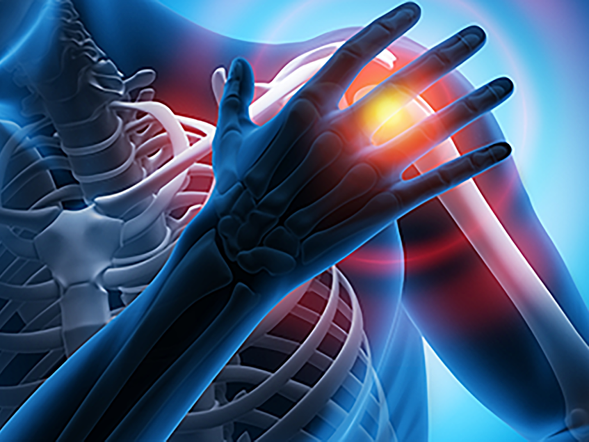 Limacorporate obtains FDA clearance for Prima shoulder platform | BioWorld