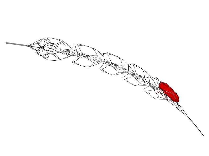 Cerenovus reports real-world benefits with Embotrap clot-removal ...