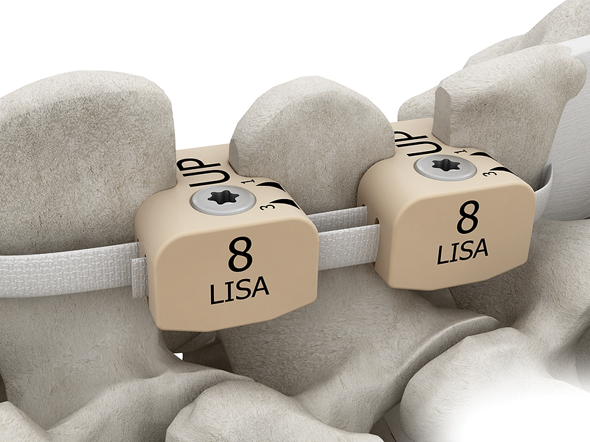 Companion Spine acquires Backbone, expanding its degenerative disc ...