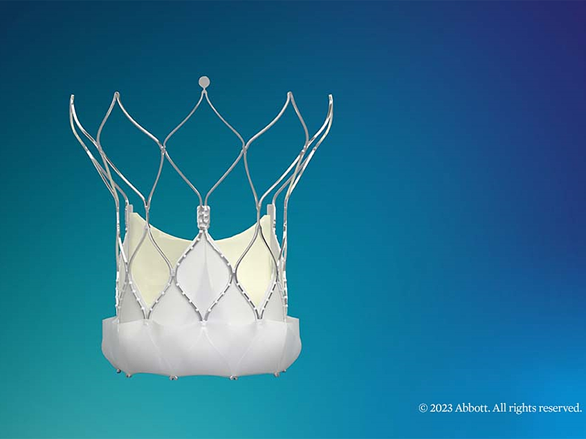 Abbott unveils positive data for Navitor TAVI device and Amplatzer ...