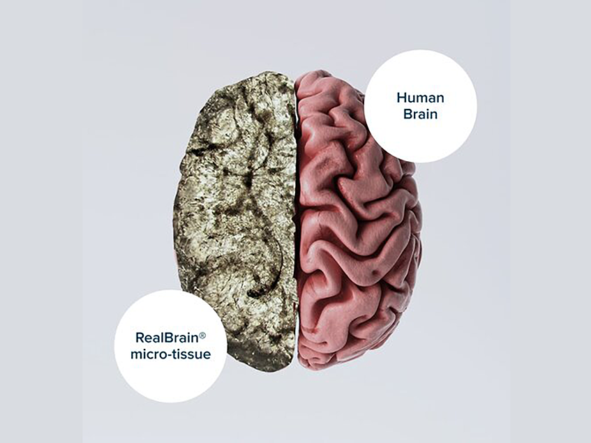 Tessara’s Realbrain platform creates 3D mini brains that mimic brain ...