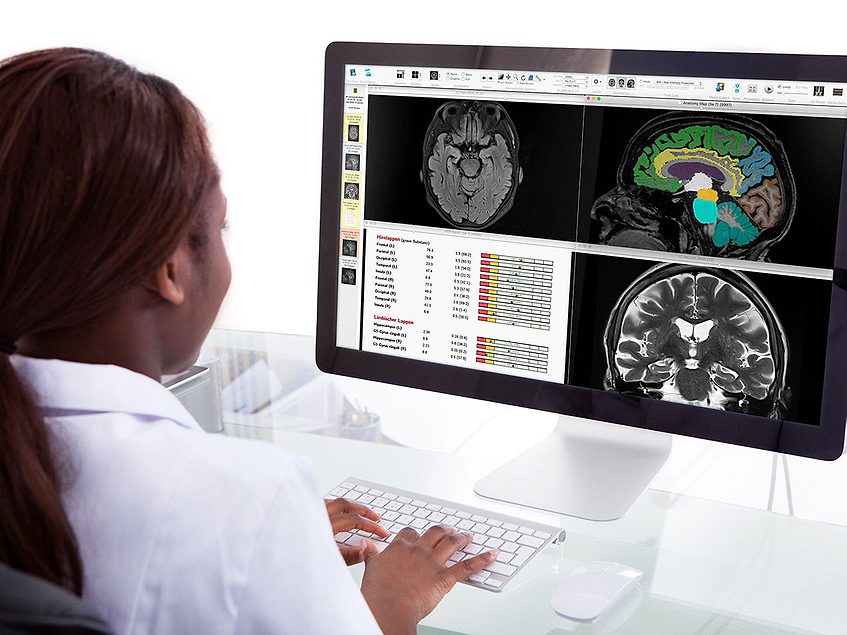 Airamed’s AI brain software a ‘game-changer’ for early Alzheimer's ...