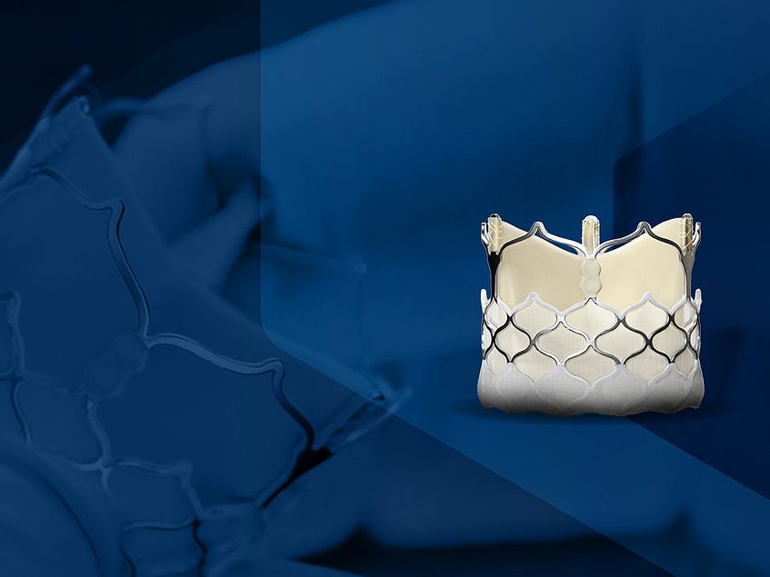 Anteris provides update on biomimetic valve for aortic stenosis | BioWorld