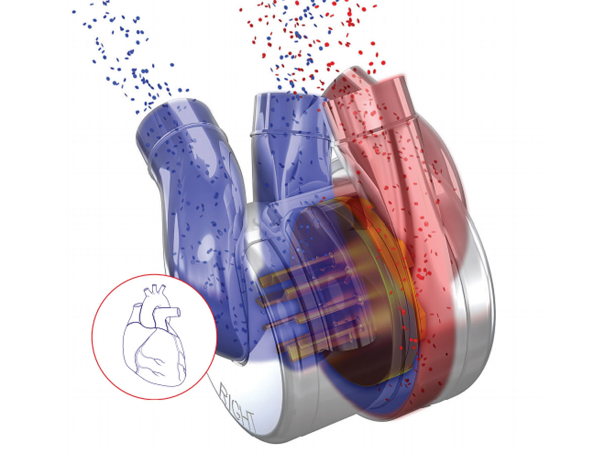 Coracao Totalmente Artificial Anatomical Human Fitting Of The BiVACOR