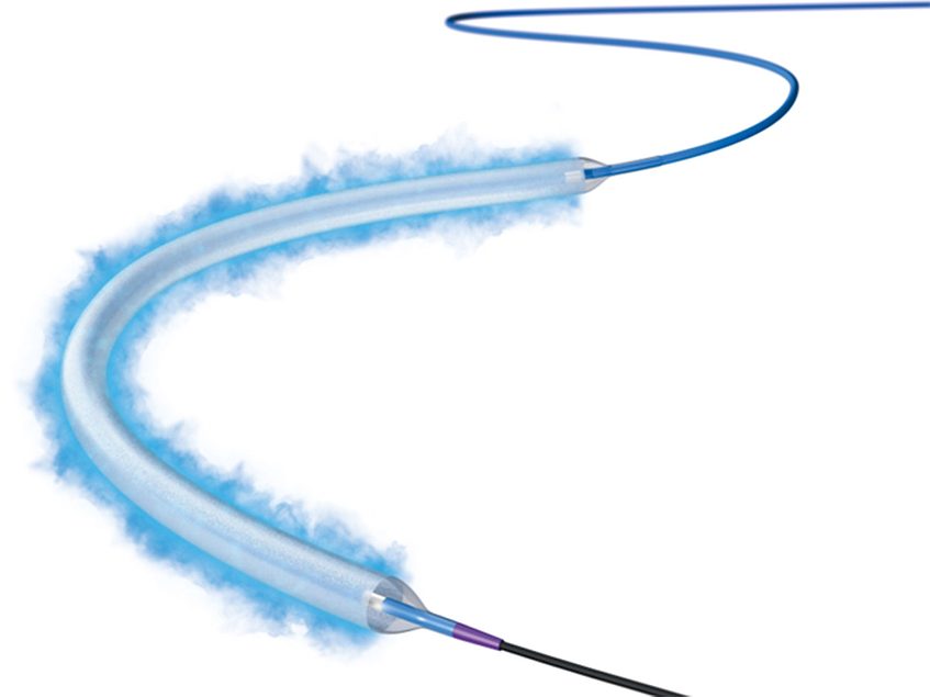 Boston Sci’s Ranger DCB shows ‘best ever’ 3-year primary patency and 4 ...