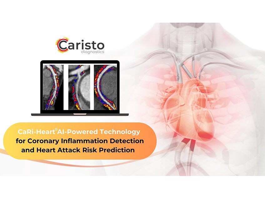 Caristo deploys Cari-Heart imagining technology in NHS pilot | BioWorld