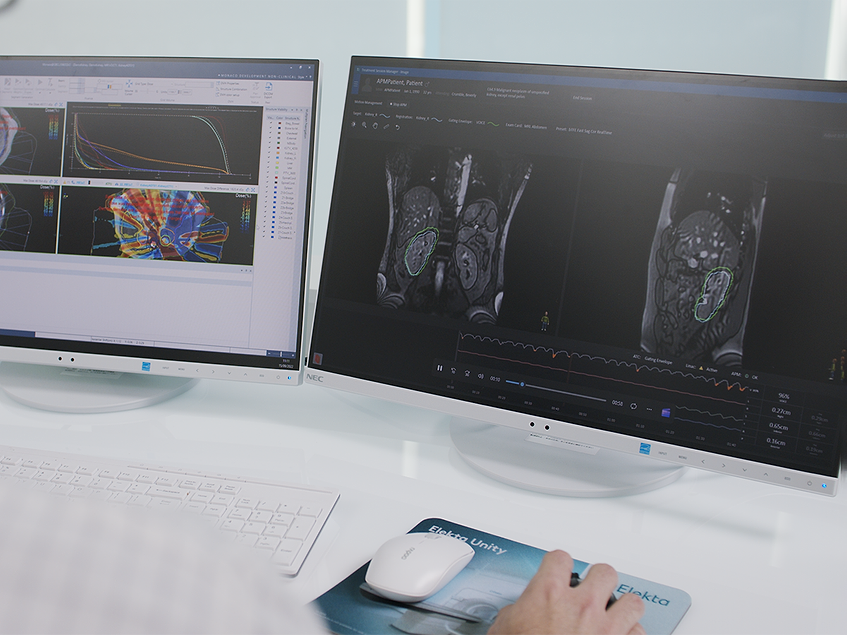 FDA clears major upgrade to Elekta’s MR-Linac system | BioWorld