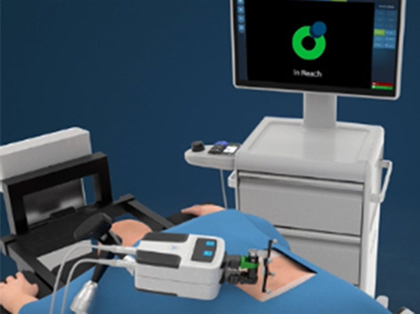 Alphatec nabs Fusion Robotics’ REMI system for $55M | BioWorld