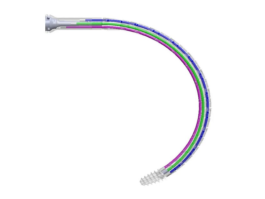 Curvafix secures $39M in series C for pelvic repair, names new CEO ...