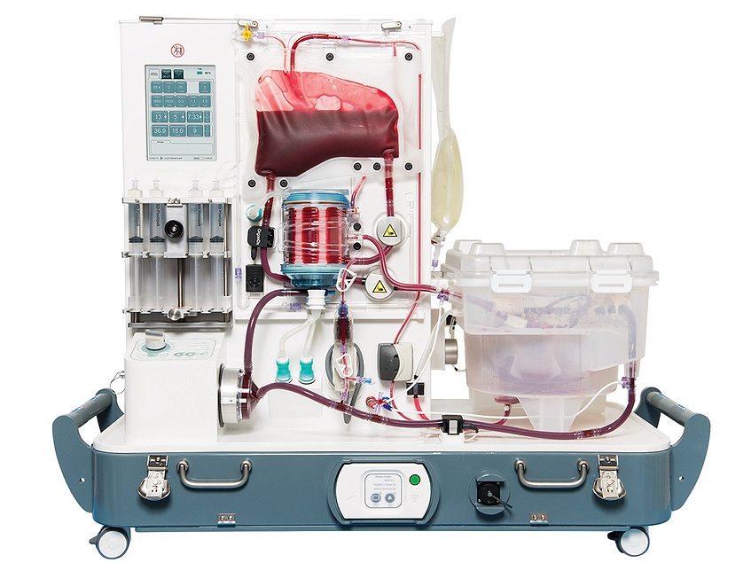 Organox liver perfusion device cleared by FDA during air transport ...