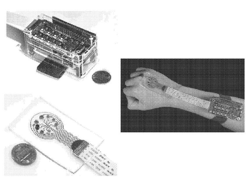 Light-sensing 3D-printed wearable for detecting lupus flare-ups | BioWorld