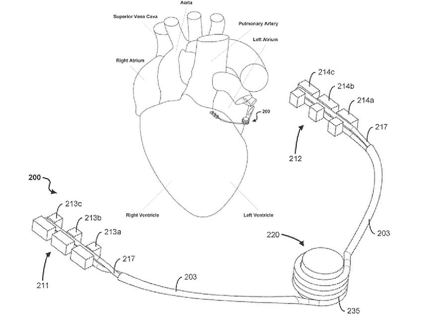 Canary sings praises of acoustic blood flow sensors for remotely ...