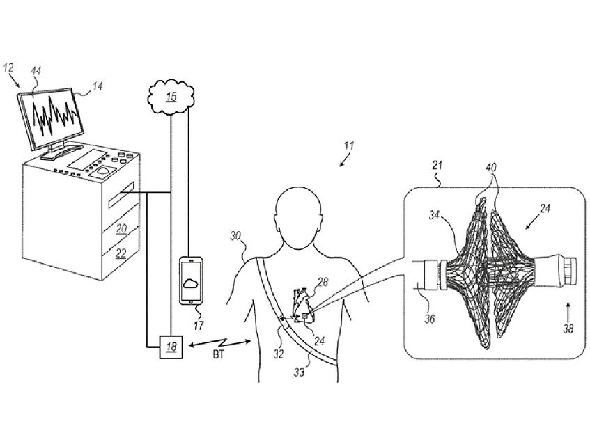 Vectorious improves accuracy of heart pressure monitoring implants ...