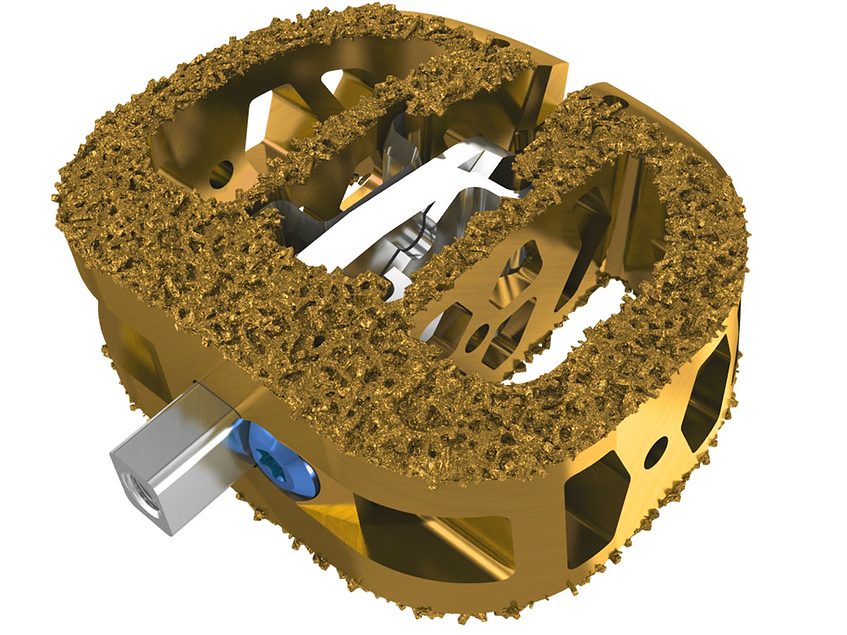 Joint venture: Nevro acquires Vyrsa for up to $75M | BioWorld