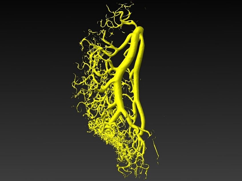 Arsenal Medical launches first-in-human trial of Neocast | BioWorld