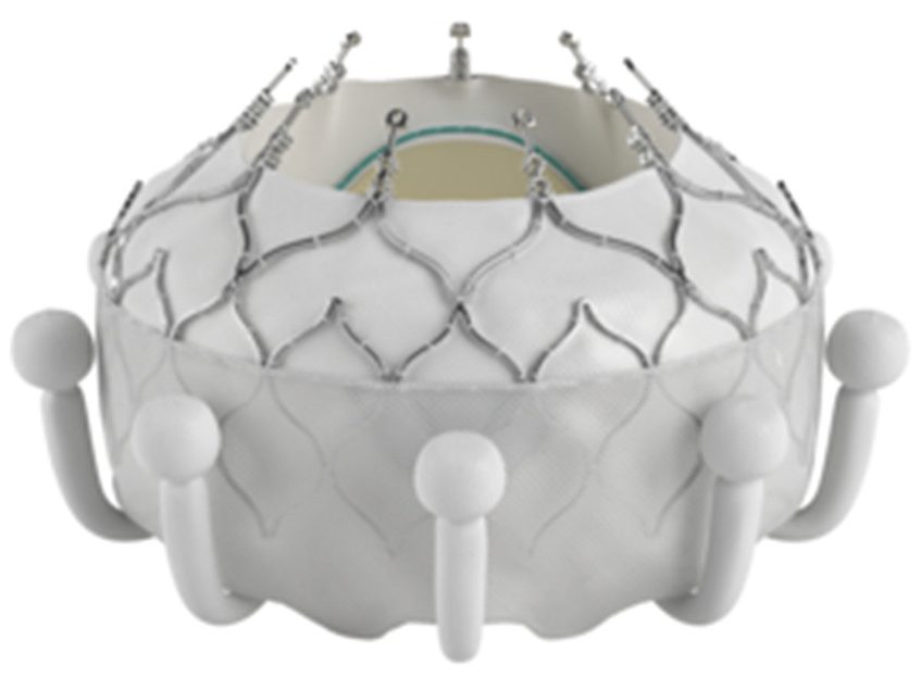 Edwards pumped about Evoque US tricuspid valve replacement approval ...