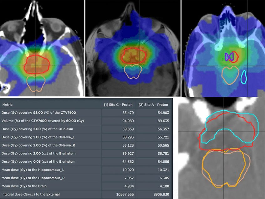 NICE taking a close look at Elekta’s Proknow systems | BioWorld