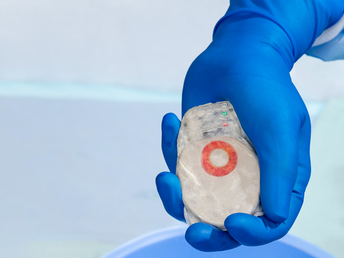 Fda Clears Medtronic Device Manager For Implanted Cardiac Devices